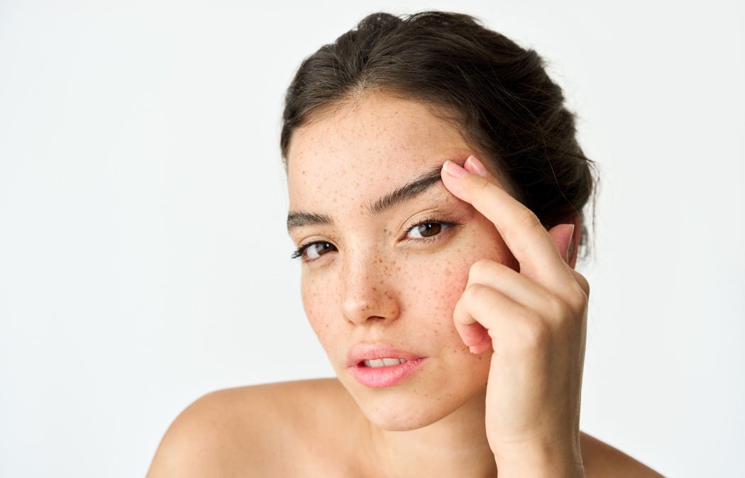 The Benefits of Microneedling for Facial Atrophic Scars | Orlando, FL